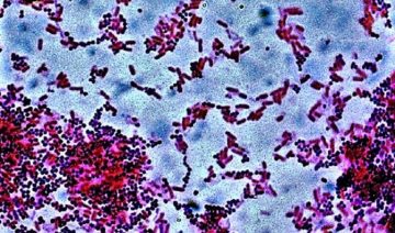 Waxes Structure | Functions | Biochemistry | Examples