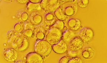 Algae | Classification, Characteristics & Examples