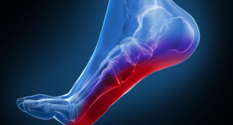 Foot Pain | Introduction, Causes and Treatment