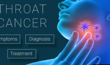 Throat Cancer | Introduction, Types, Symptoms & Treatment