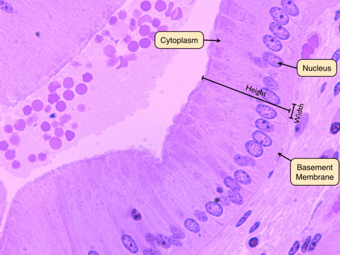 Simple Squamous Epithelium |Inrtroducrion , Anatomy & Function